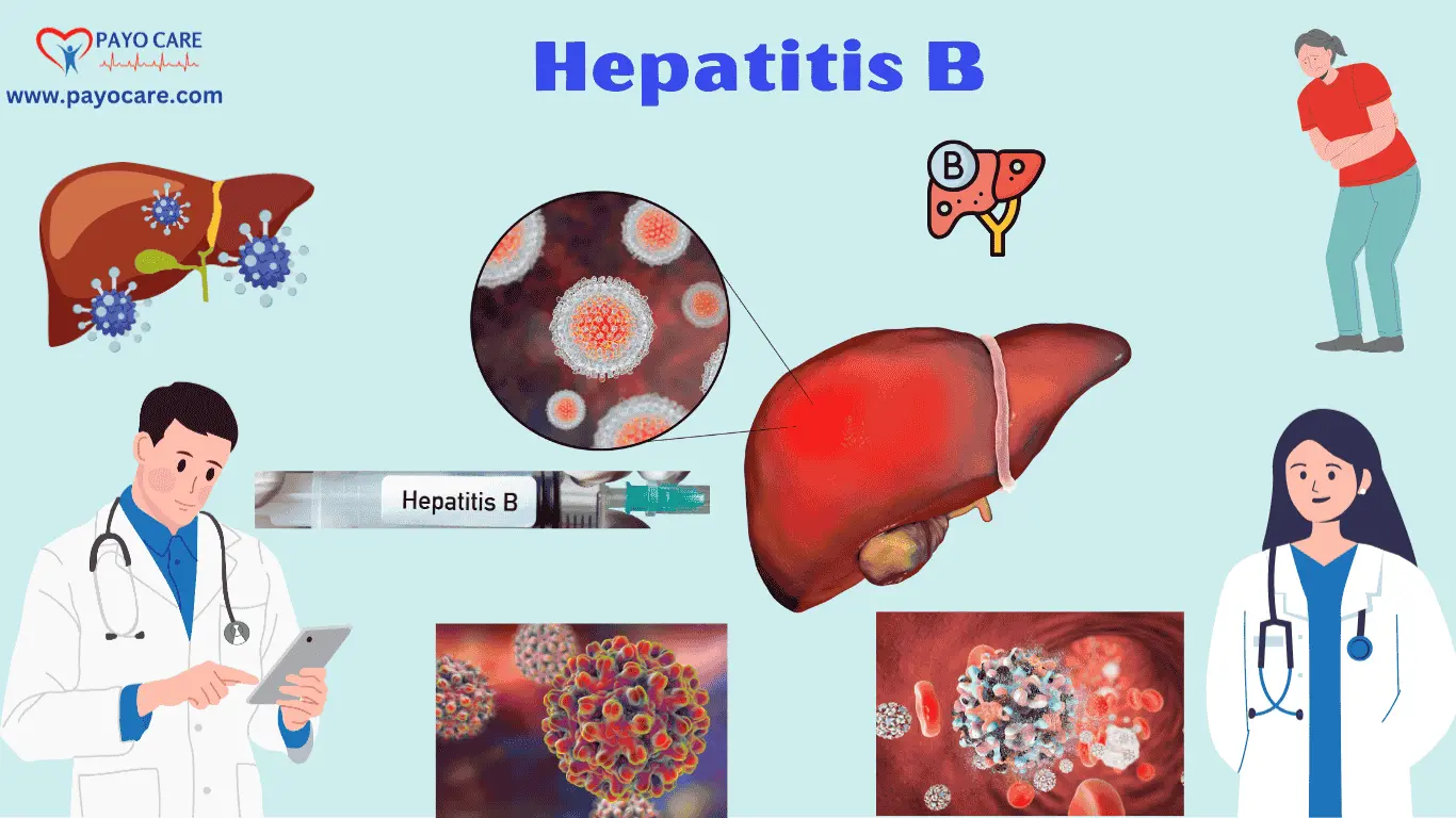 Hepatitis B: Causes, Symptoms, Treatment & Prevention - Payo Care