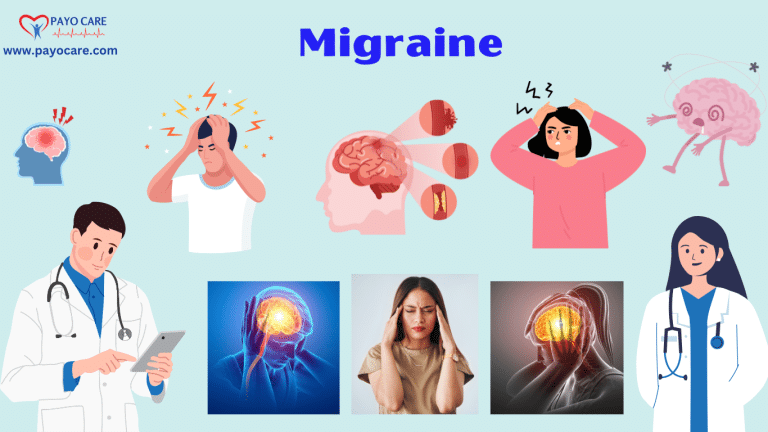 Migraines: Causes, Symptoms &Treatment – PAYO CARE provides expert ...