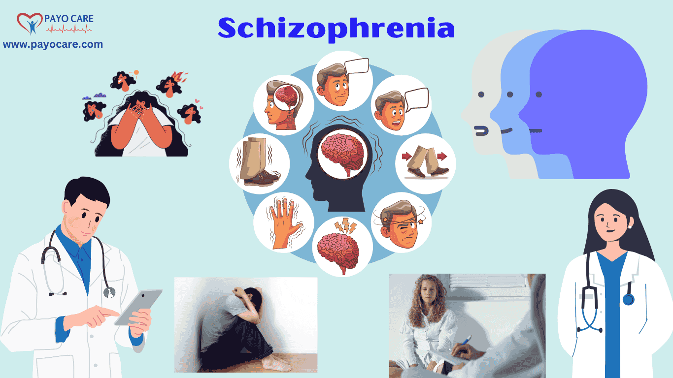 Schizophrenia: Types, Causes, Symptoms & Treatment - Payo Care