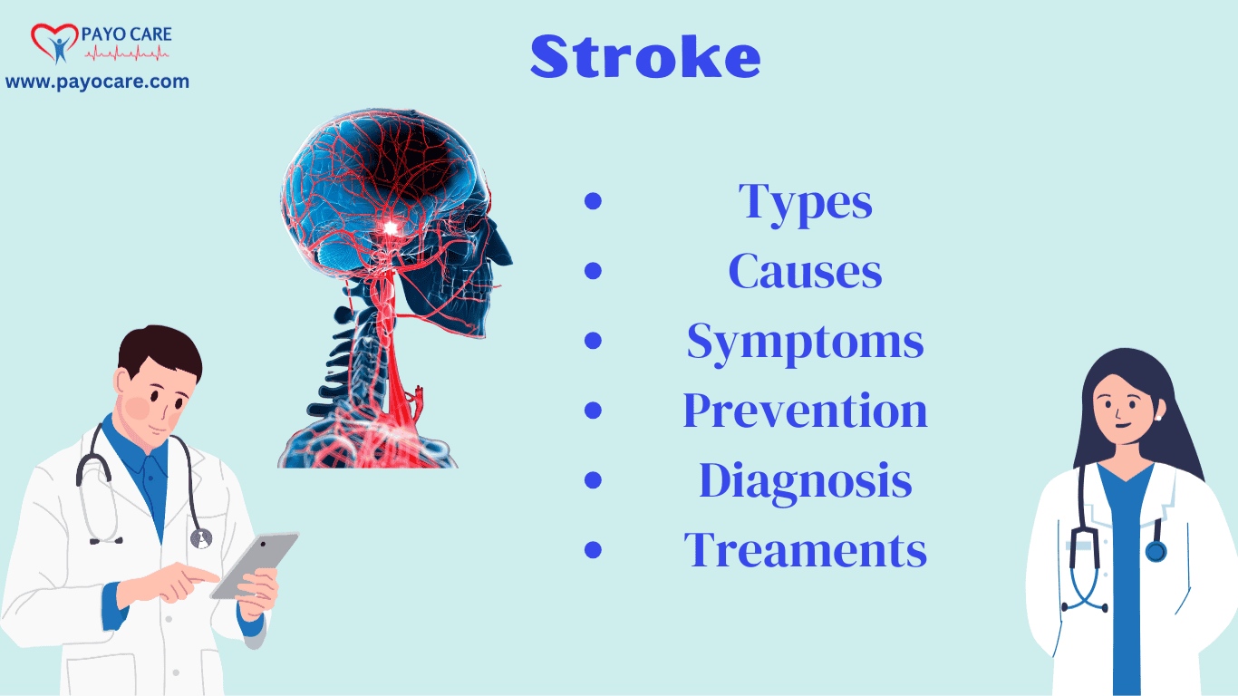 Stroke: Causes, Symptoms & Prevention – PAYO CARE provides expert ...
