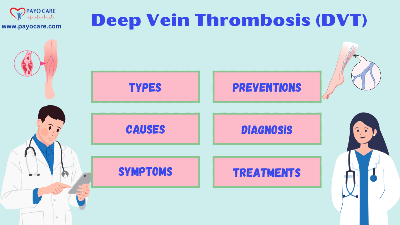 Deep Vein Thrombosis (DVT): Causes, Symptoms and Treatments – PAYO CARE ...