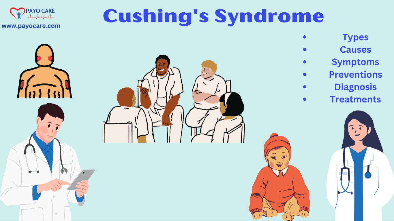 Cushing’s Syndrome: Causes, Symptoms and Treatments - Payo Care
